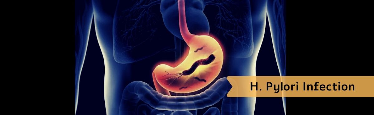 What Is H. Pylori Infection and Why You Should Worry About It ...